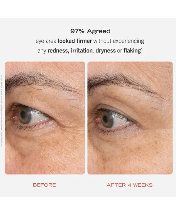 FIRST AID BEAUTY Retinol Eye Cream With Squalane + Ceramides