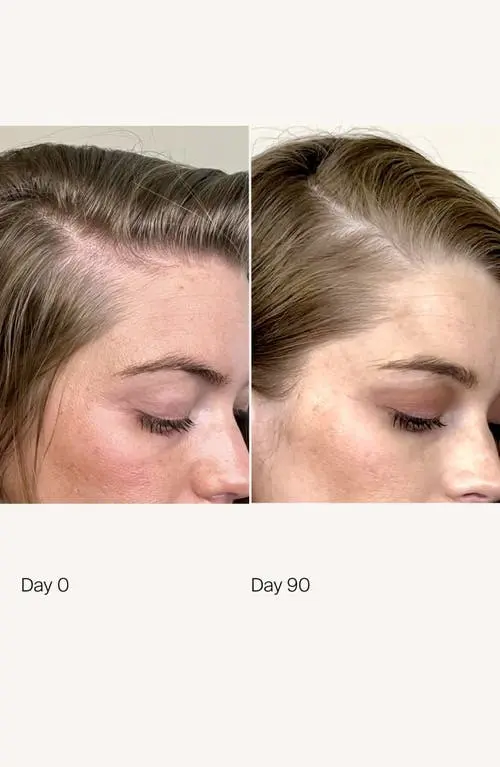 LIVING PROOF® Scalp Care Density Serum