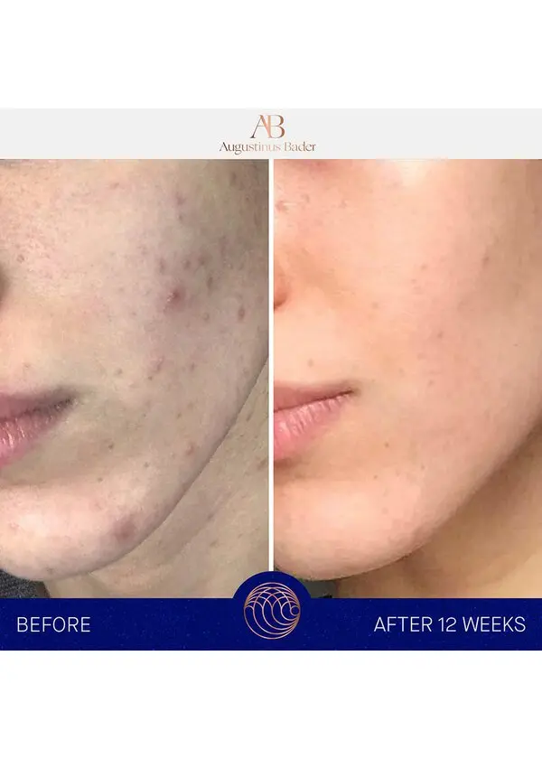Augustinus Bader The Moisturisers Lightweight, Hydrating And Illuminating