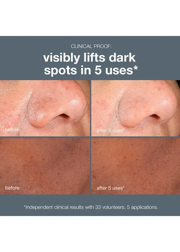 DERMALOGICA Powerbright Spot Peel