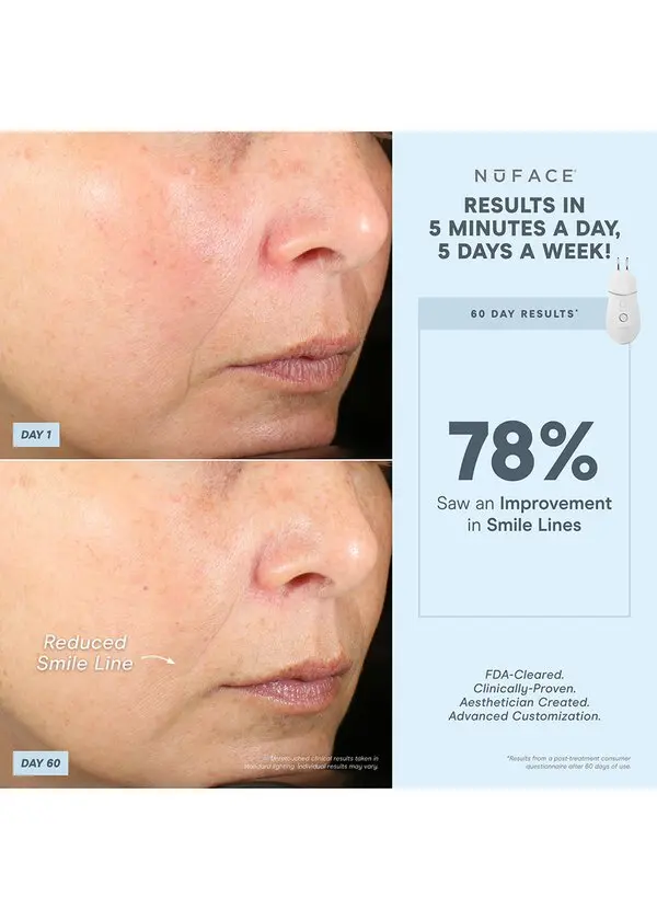 NUFACE Trinity+ Effective Lip & Eye Attachment