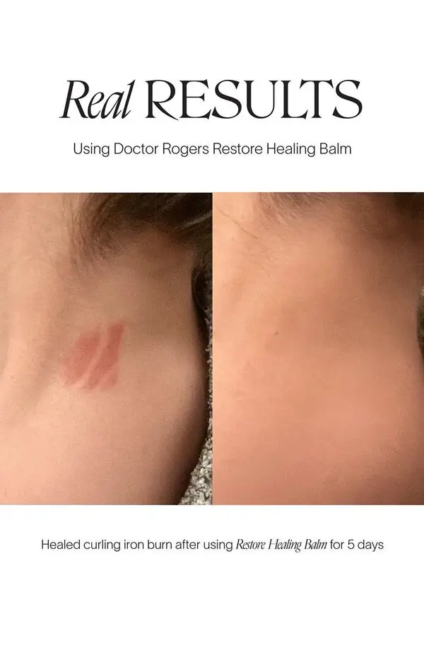 DOCTOR ROGERS RESTORE Restore Healing Balm
