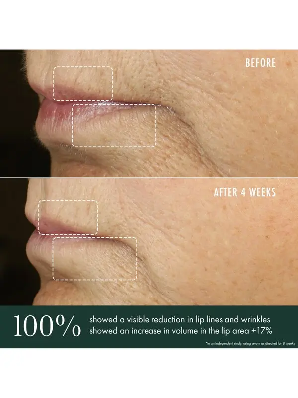 RÉVIVE Renewal Advanced Lip Perioral Serum Targeted Vertical Line Filler