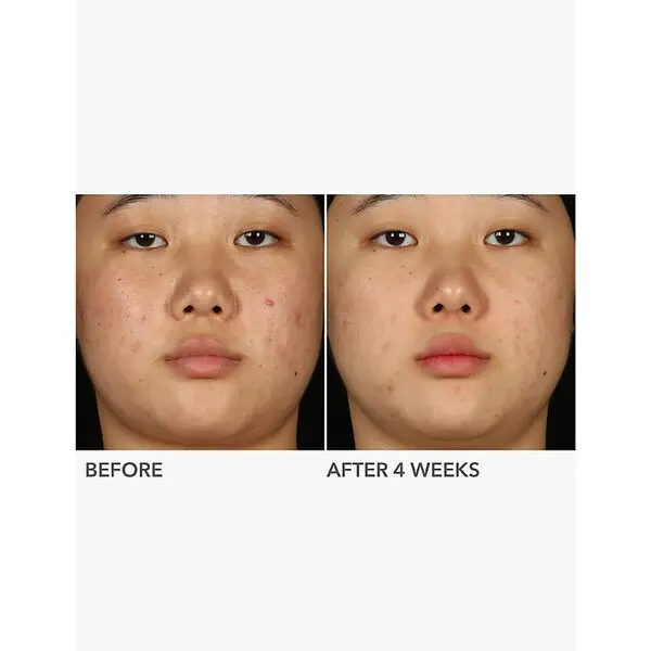DR. DENNIS GROSS SKINCARE Alpha Beta 2% Bha+ Liquid Solution