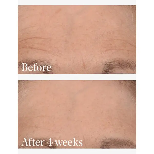 MURAD Resurgence Retinal Resculpt™ Overnight Treatment - One-color