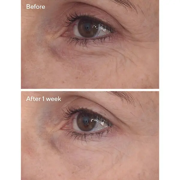 MURAD Retinal Resculpt Eye Treatment - One-color