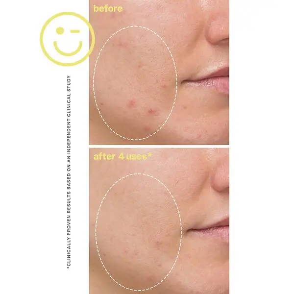 KATE SOMERVILLE Mega C-vit 30% Vitamin C Brightening Facial