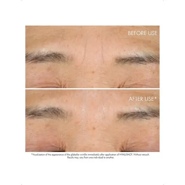 Dior Capture Totale Hyalushot - One-color