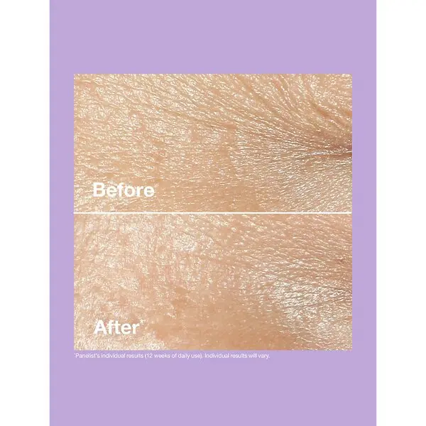 CLINIQUE Smart™ Clinical Repair Wrinkle Correcting Cream 75ml - One-color
