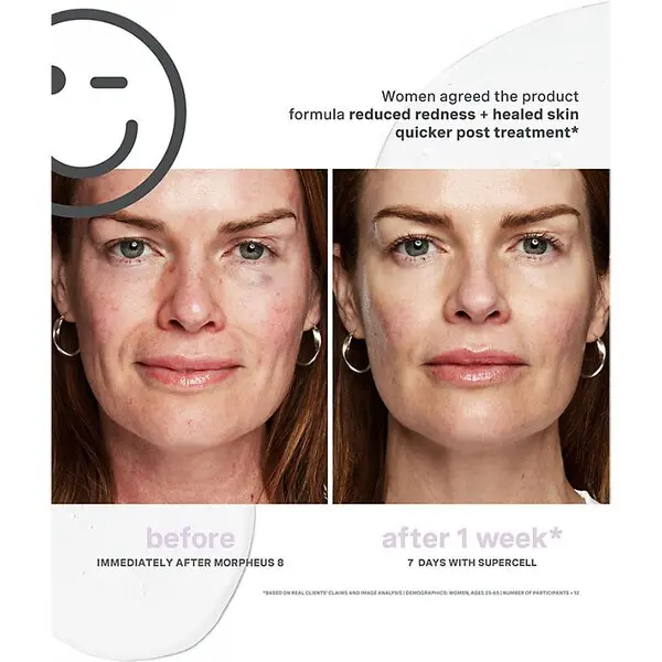 KATE SOMERVILLE Kateceuticals Supercell Rejuvenation Serum - One-color
