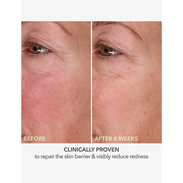 DR. DENNIS GROSS SKINCARE Derminfusions™ Fill + Repair Serum 30ml