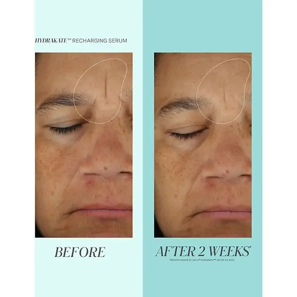 KATE SOMERVILLE Hydrakate™ Recharging Serum - Na