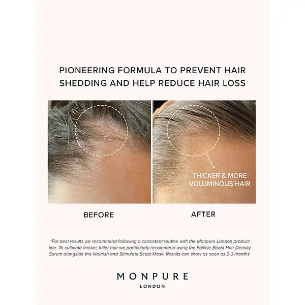 MONPURE LONDON Follicle Boost Hair Density Serum