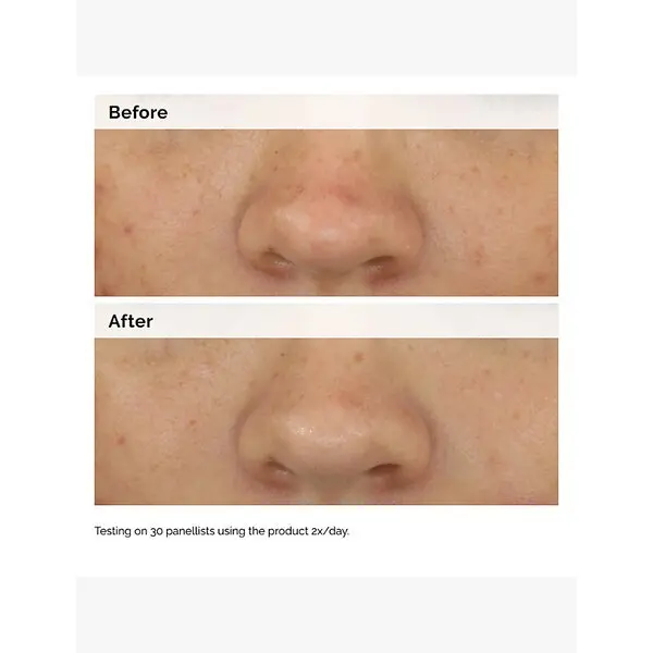THE ORDINARY Balancing And Clarifying Serum - One-color