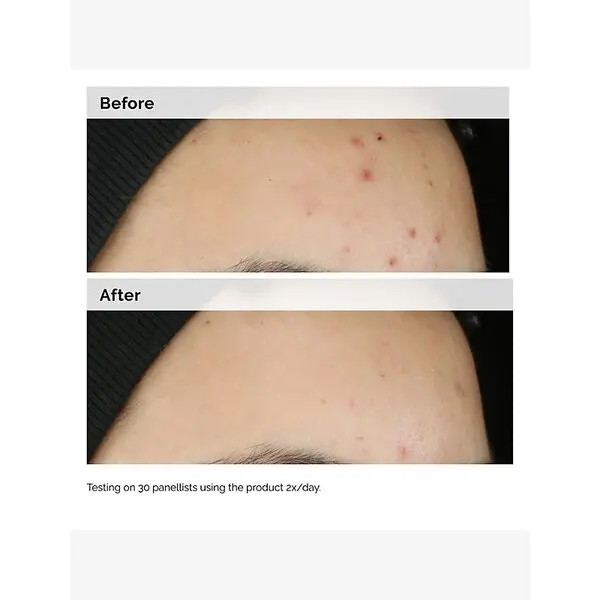 THE ORDINARY Balancing And Clarifying Serum - One-color