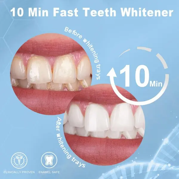MYSMILE Teeth Whitening Kit For Sensitive Teeth With Led Light