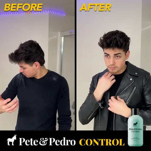 PETE & PEDRO Control Extra-strength Anti-dandruff & Anti-itch Shampoo - None