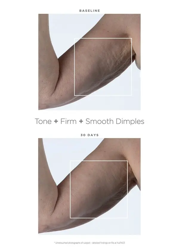 NUFACE Nubody Skin Toning Device