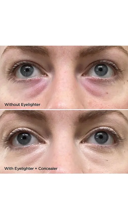 BEAUTYBIO The Eyelighter Concentrate - N,a