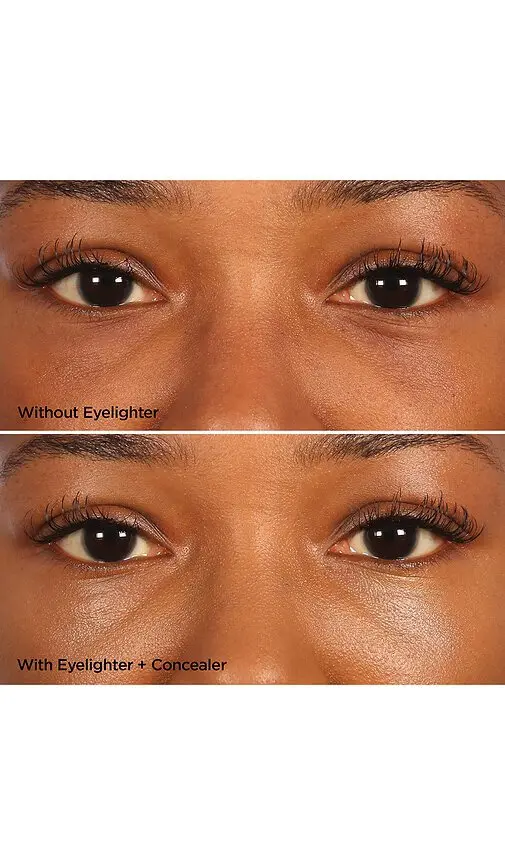 BEAUTYBIO The Eyelighter Concentrate - N,a