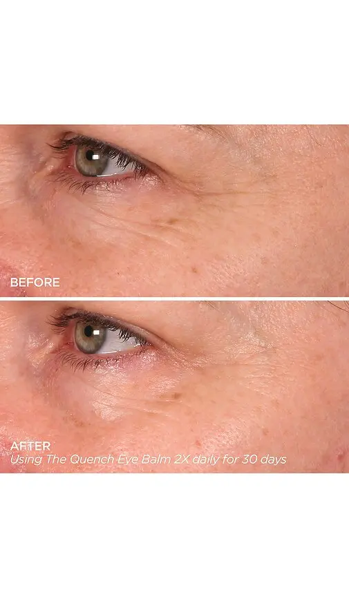 BEAUTYBIO The Quench Eye Balm