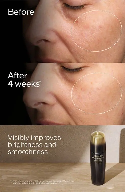 SHISEIDO Future Solution Lx Concentrated Brightening Softener - Regular