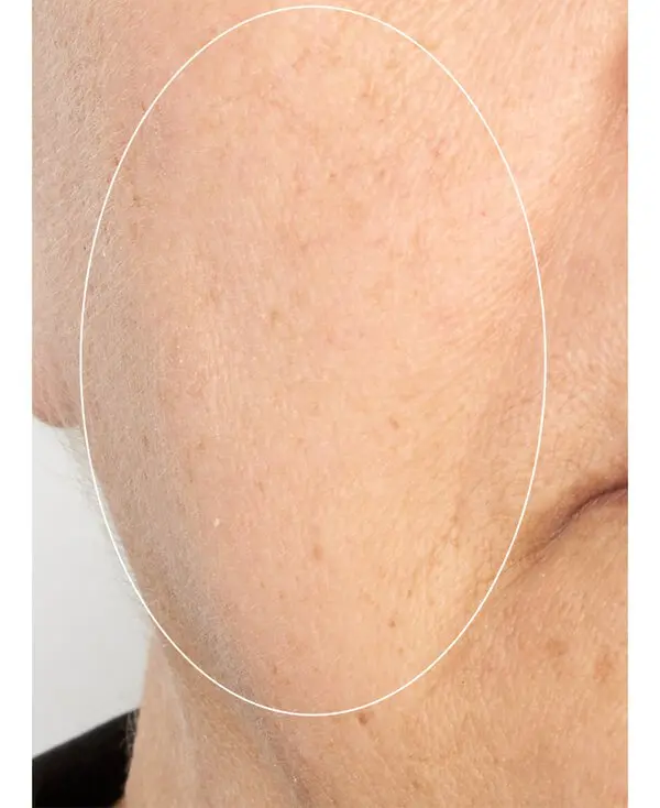 PERRICONE MD Hp Intensive Smoothing Serum