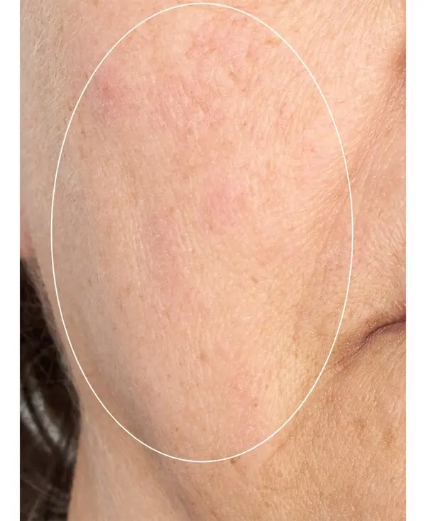 PERRICONE MD Hp Intensive Smoothing Serum