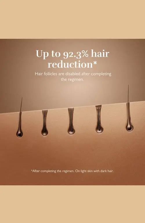 Silk'N 7 Hair Removal Device