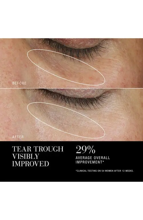Estée Lauder Re-nutriv Ultimate Diamond Age Reversal Eye Cream