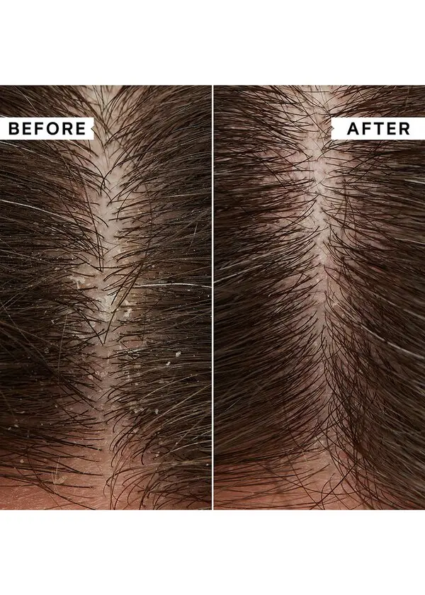 PHILIP KINGSLEY Flaky/itchy Scalp Anti-dandruff Shampoo