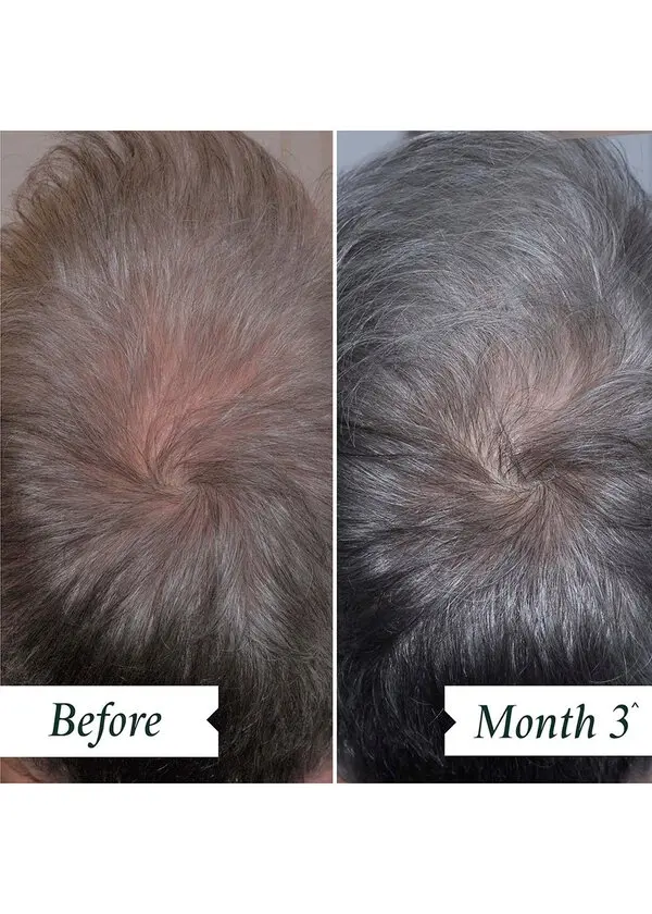 PHILIP KINGSLEY Density Preserving Scalp Drops - N/a