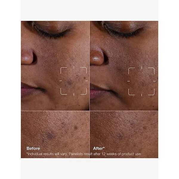 CLINIQUE Even Better Clinical Dark Spot Clearing Serum - One-color