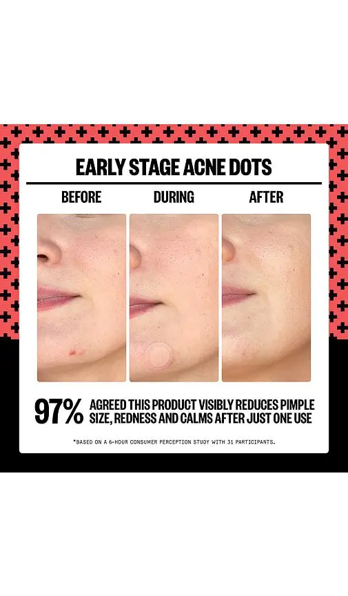 PEACE OUT 2% Salicylic Acid Early Stage Acne Dot 8 Dots - N,a