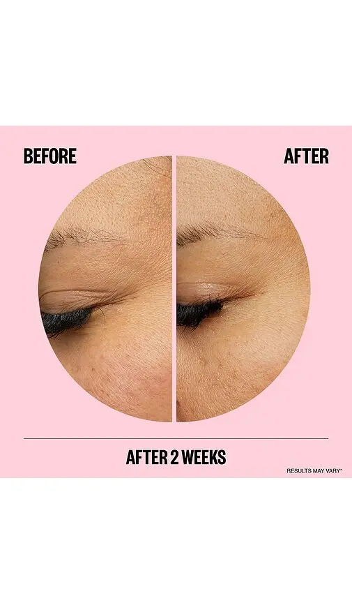 PEACE OUT Microneedling Anti-wrinkle Retinol Patches