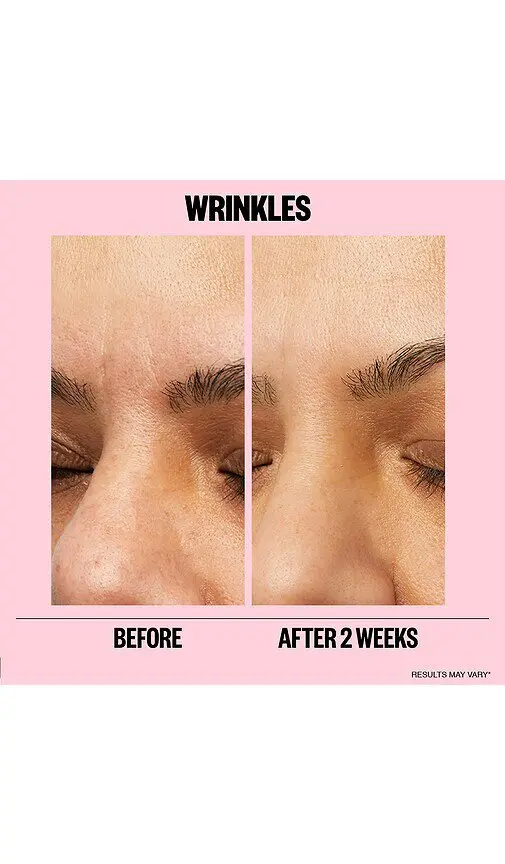PEACE OUT Microneedling Anti-wrinkle Retinol Patches