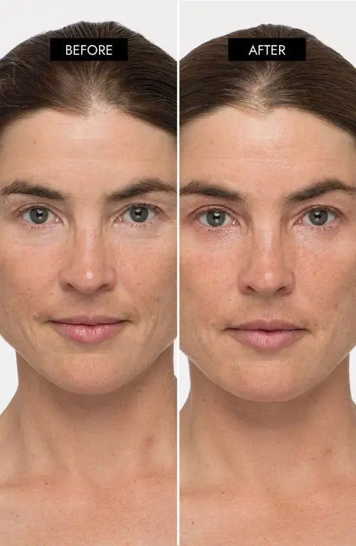 7E WELLNESS Myolift Triwave Advanced Microcurrent Facial Device - None
