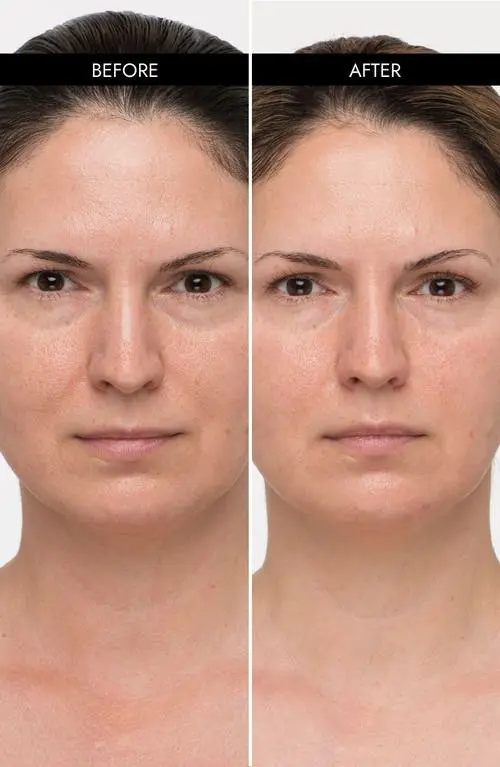 7E WELLNESS Myolift Mini Microcurrent Facial Toning Device - None