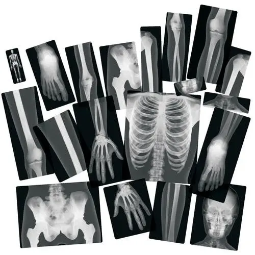 ROYLCO Human X-rays On Film