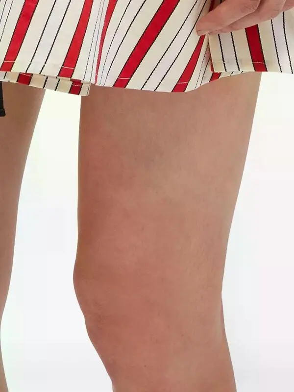MSGM Striped Mini Dress