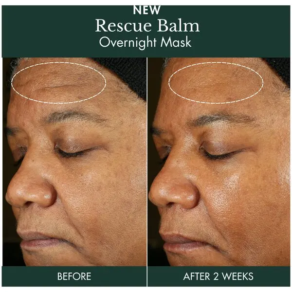 RéVive® Rescue Balm Overnight Mask 75ml - One-color