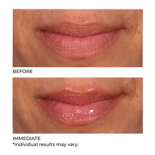 DR. NASSIF SKINCARE Hydro-screen For Lips - Pink Champagne