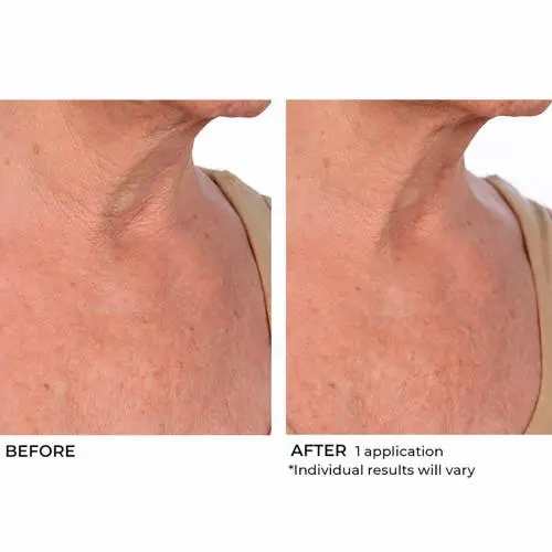 DR. NASSIF SKINCARE Hydro-screen Souffle