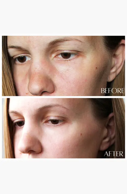 BOTANICARY No. 2 Refresh Orchid Stem Cell & Vitamin C Essence Facial Mist