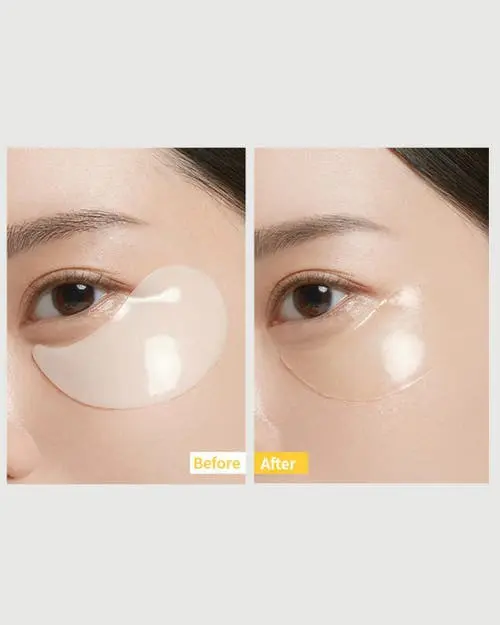 MEDIANSWER Vita Collagen Eye Cream Patch
