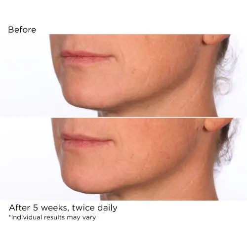 DR. NASSIF SKINCARE Hydro-screen Serum - 4oz