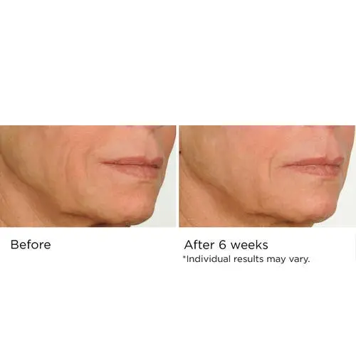 DR. NASSIF SKINCARE Night Therapy Serum 1oz