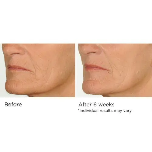 DR. NASSIF SKINCARE Night Therapy Serum 1oz