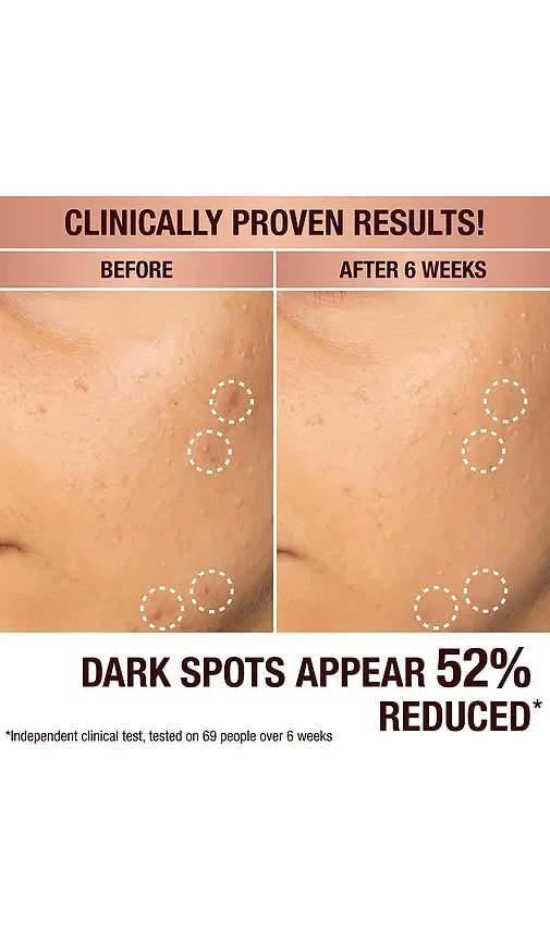 Charlotte Tilbury Dark Spot Correcting Radiance Recovery Serum 10ml