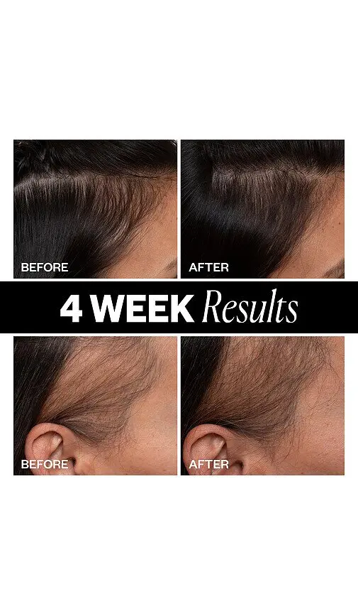 IGK Sponsored Hair Density Scalp Treatment - N,a